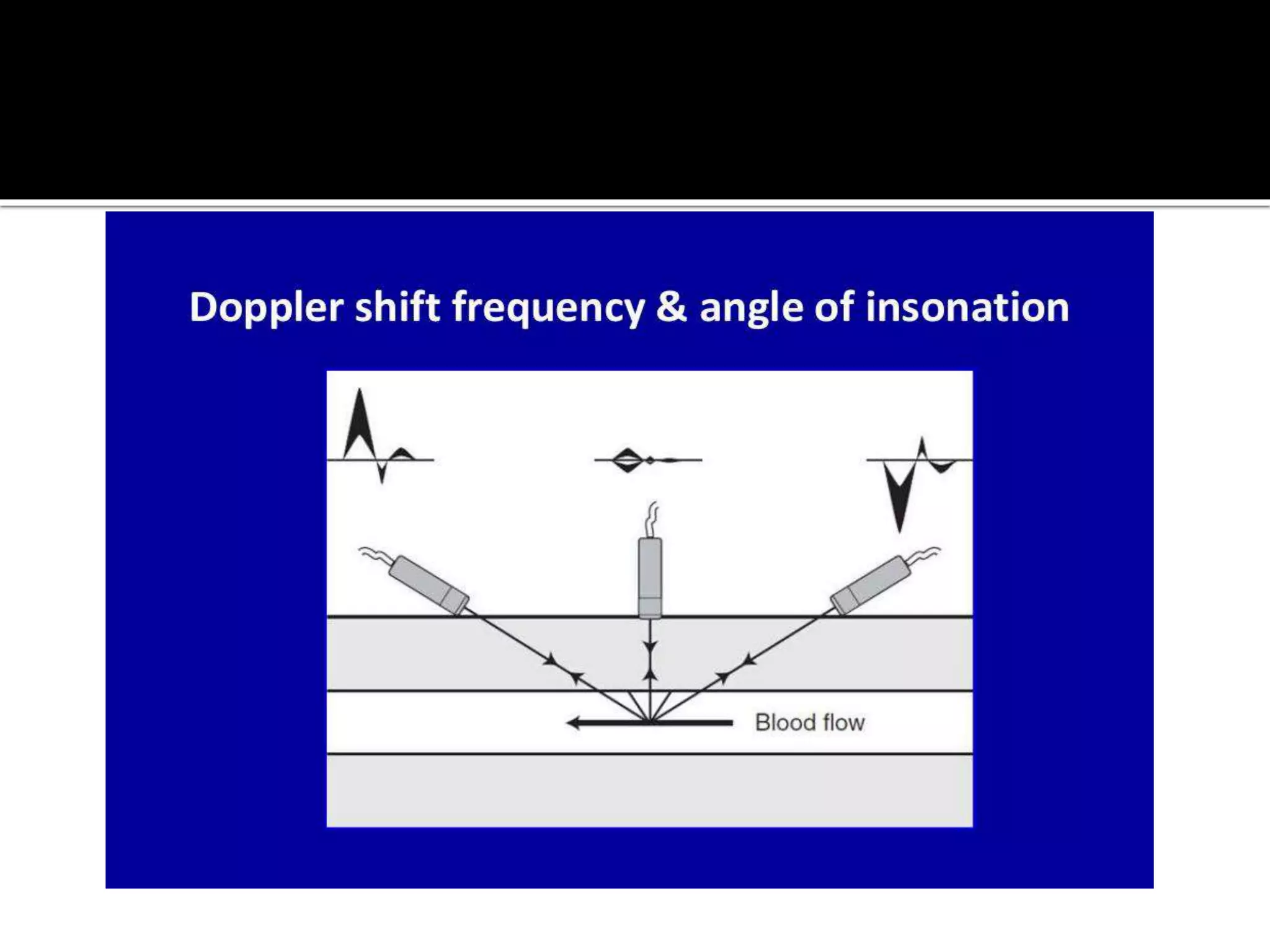 Doppler study general bases | PPT