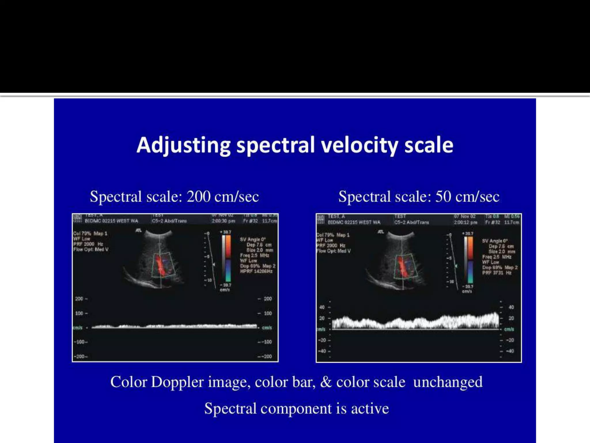 Doppler study general bases | PPT
