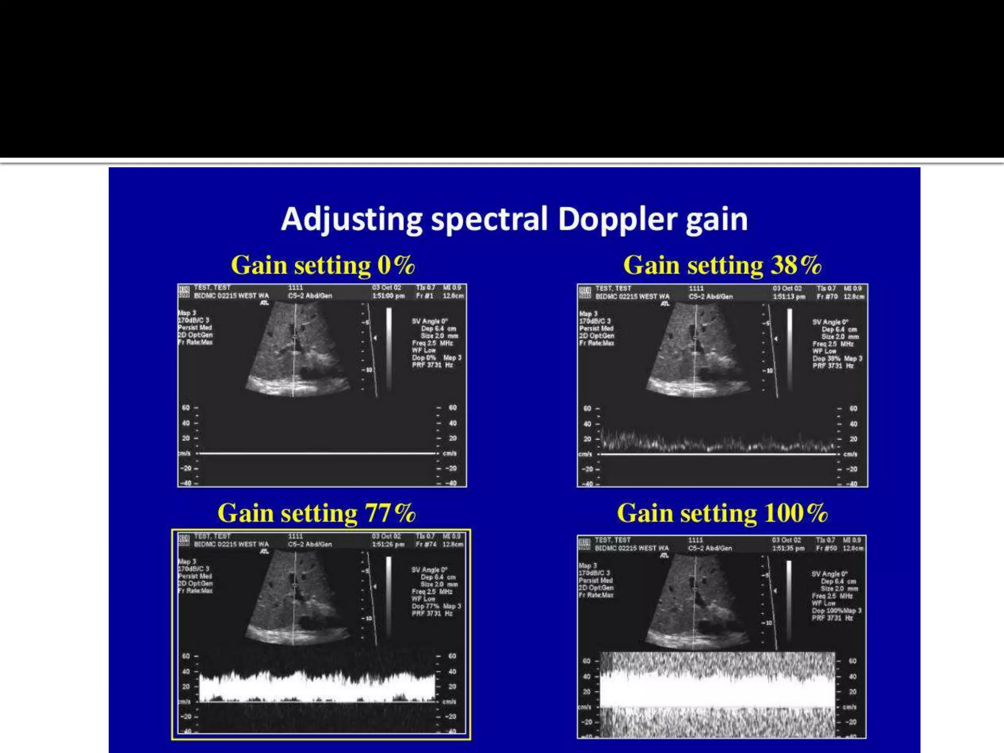 Doppler study general bases | PPT