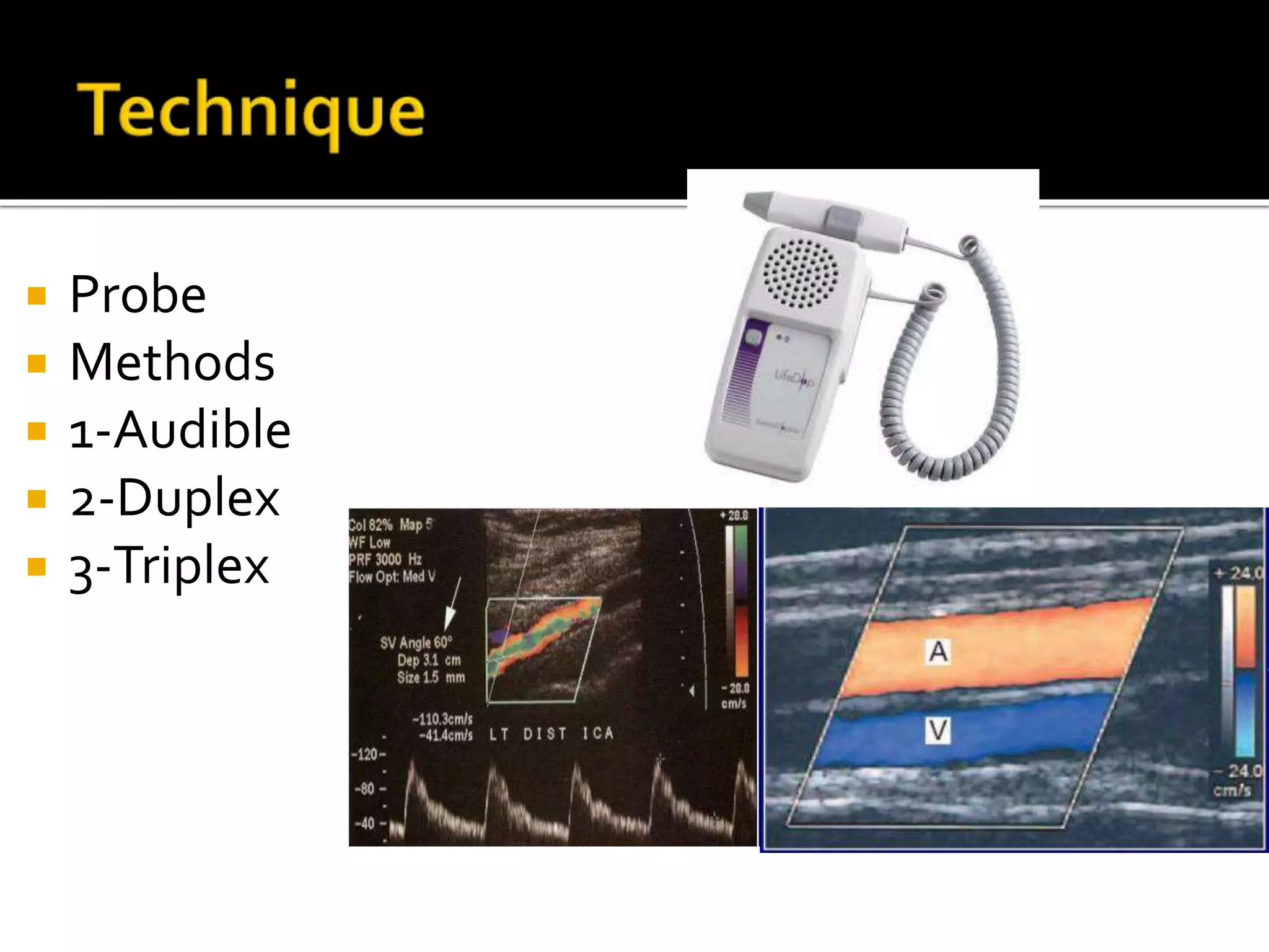 Doppler study general bases | PPT