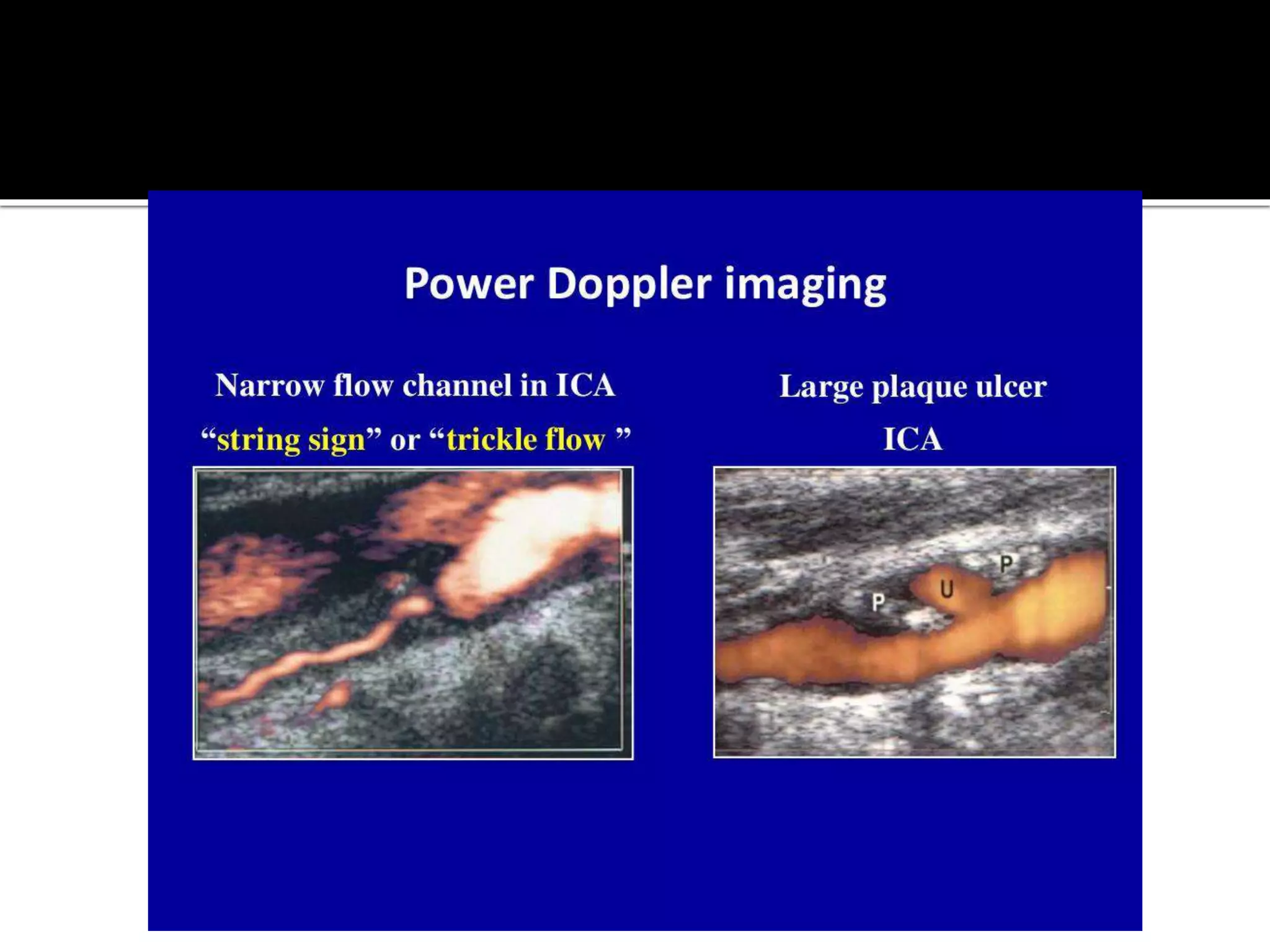 Doppler study general bases | PPT