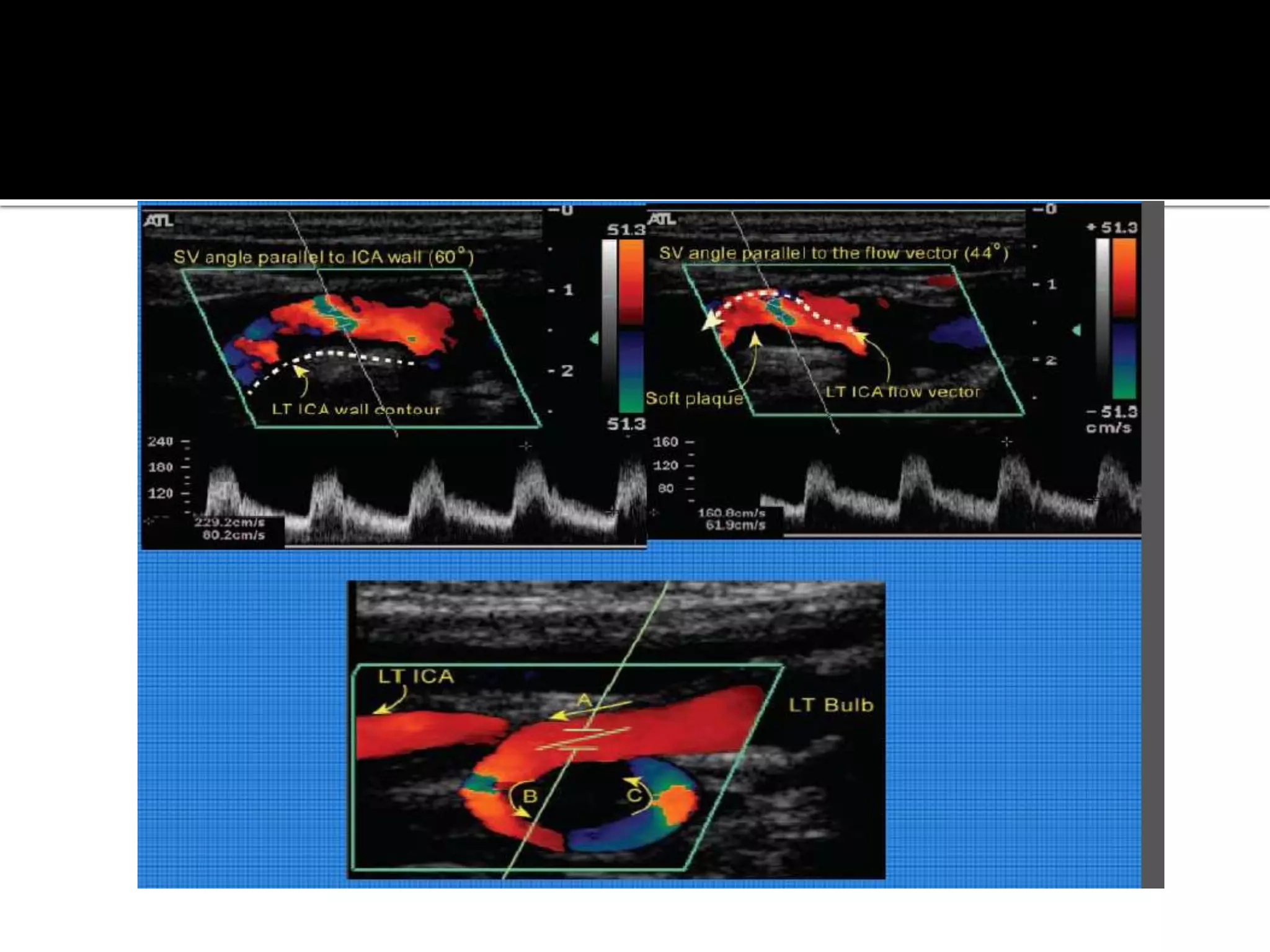 Doppler study general bases | PPT