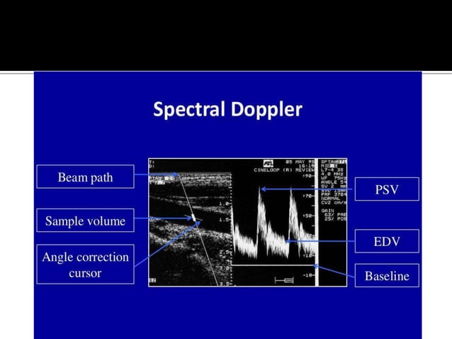 Doppler study general bases | PPT