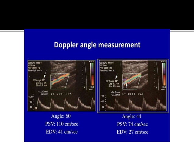 Doppler study general bases | PPT