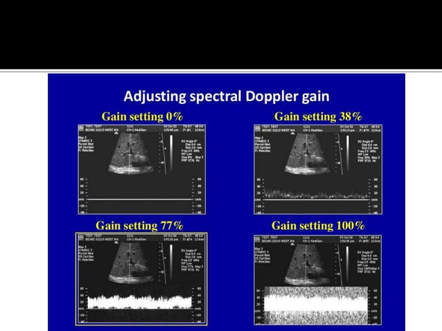 Doppler study general bases | PPT