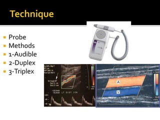 Doppler study general bases | PPTX