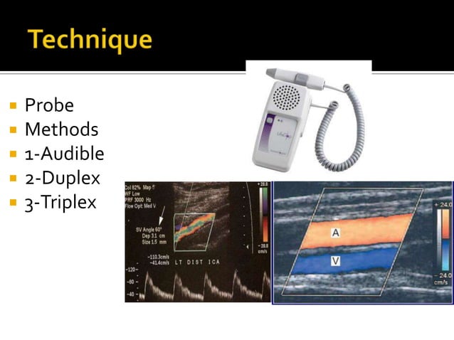 Doppler study general bases | PPT