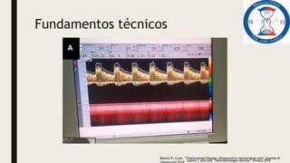 Doppler transcraneal.pptx