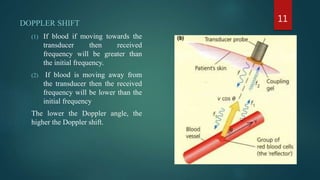 Doppler ultrasonography | PPTX