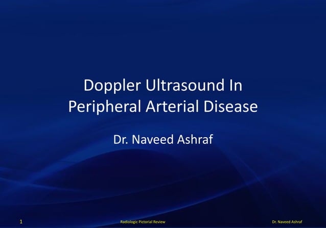 Doppler ultrasound in peripheral arterial disease | PDF | Heart and ...