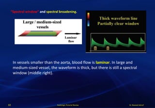 Doppler ultrasound in peripheral arterial disease | PDF