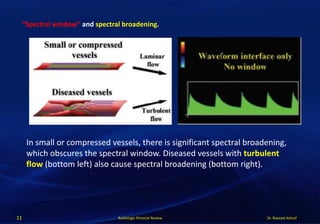 Doppler ultrasound in peripheral arterial disease | PDF