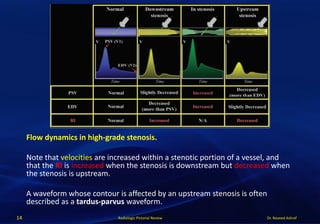 Doppler ultrasound in peripheral arterial disease | PDF