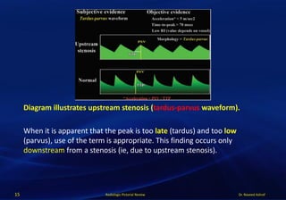 Doppler ultrasound in peripheral arterial disease | PDF