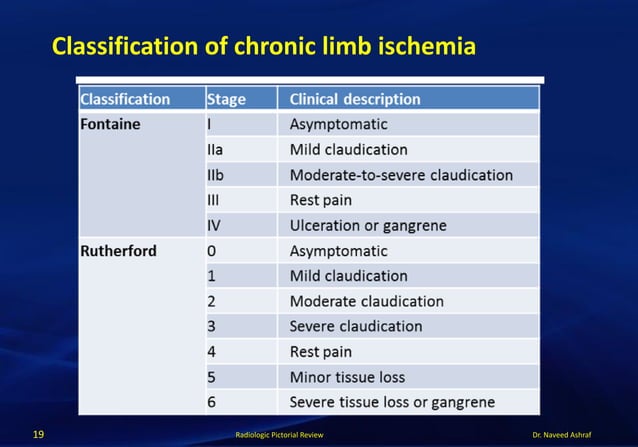 Doppler ultrasound in peripheral arterial disease | PDF | Heart and ...