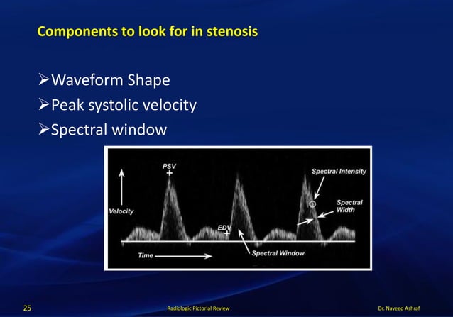 Doppler ultrasound in peripheral arterial disease | PDF | Heart and ...