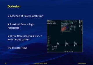 Doppler ultrasound in peripheral arterial disease | PDF