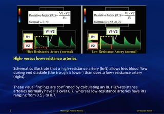 Doppler ultrasound in peripheral arterial disease | PDF