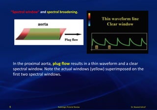 Doppler ultrasound in peripheral arterial disease | PDF