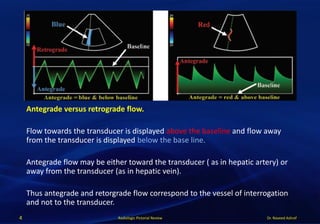 Doppler ultrasound in peripheral arterial disease | PPT