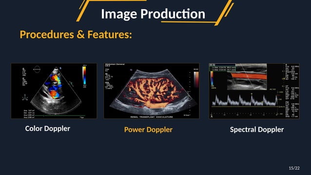 An overview on Doppler Ultrasound Imaging | PPTX