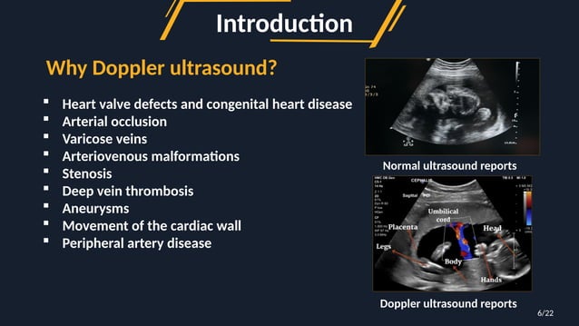 An overview on Doppler Ultrasound Imaging | PPTX