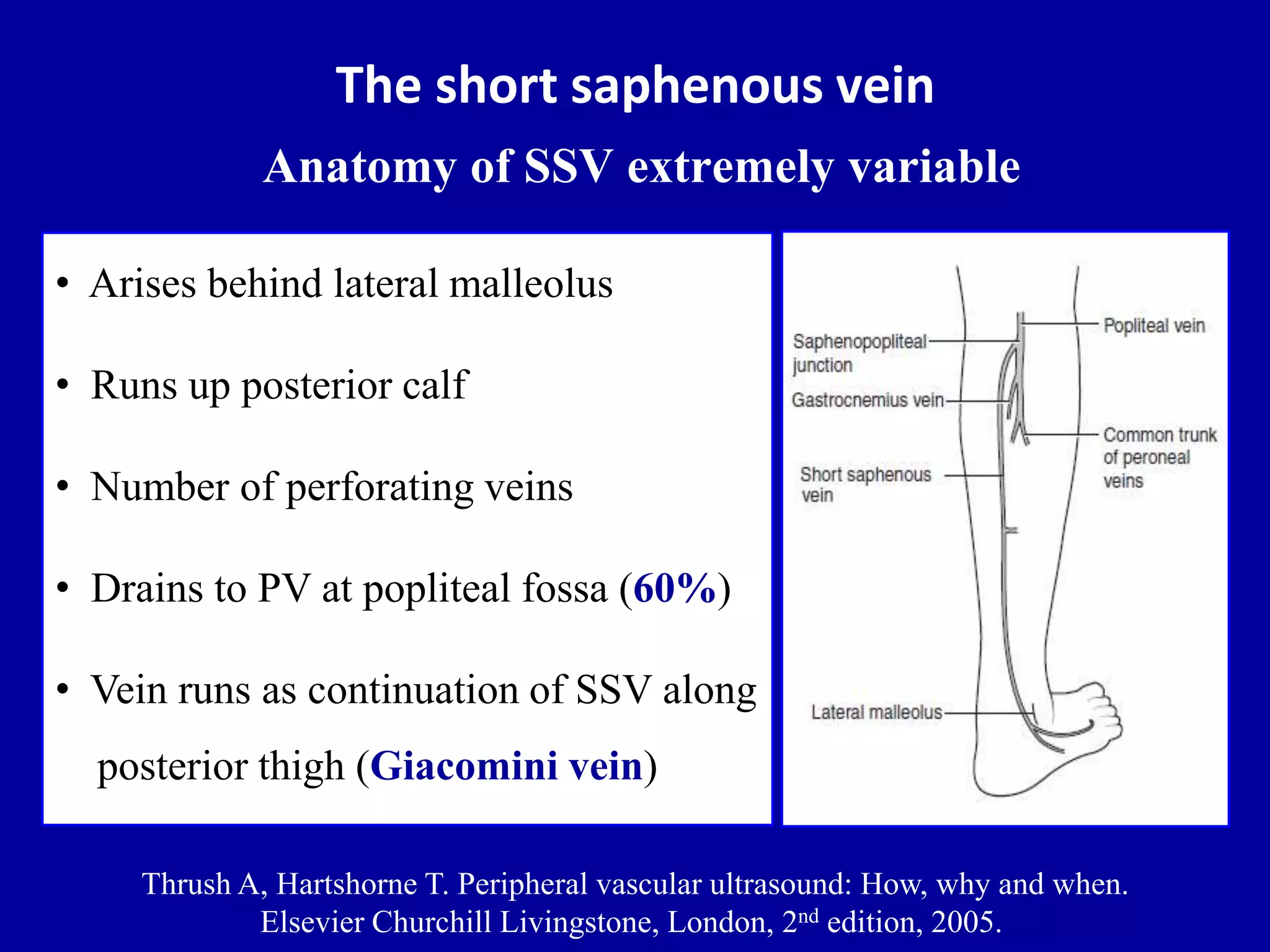 Doppler ultrasound in deep vein thrombosis | PPTX