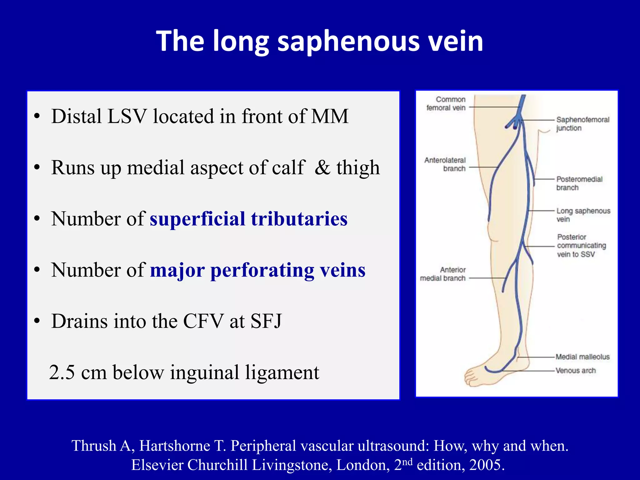 Doppler ultrasound in deep vein thrombosis | PPTX