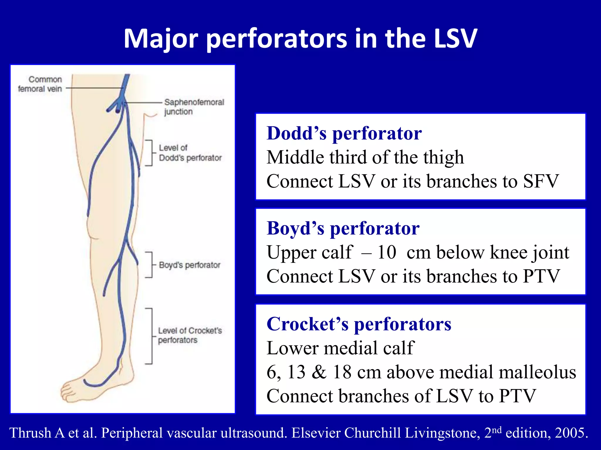 Doppler ultrasound in deep vein thrombosis | PPTX