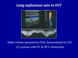 Doppler ultrasound in deep vein thrombosis | PPTX