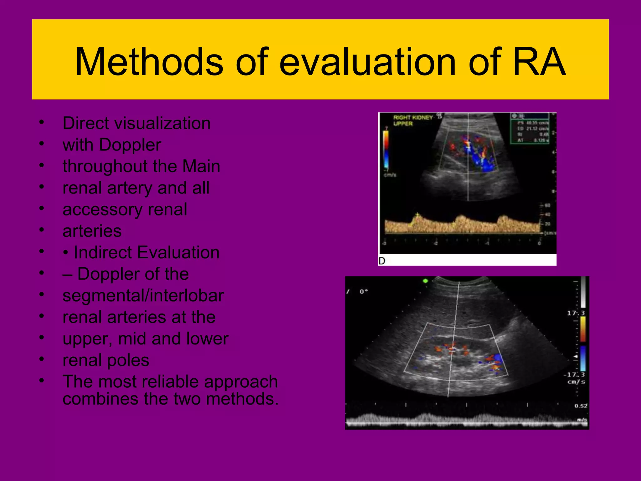 Doppler ultrasound in renal patients | PPT
