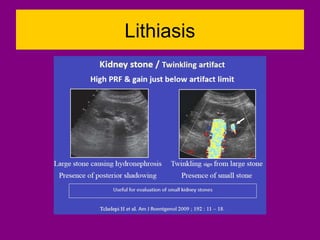Doppler ultrasound in renal patients | PPT