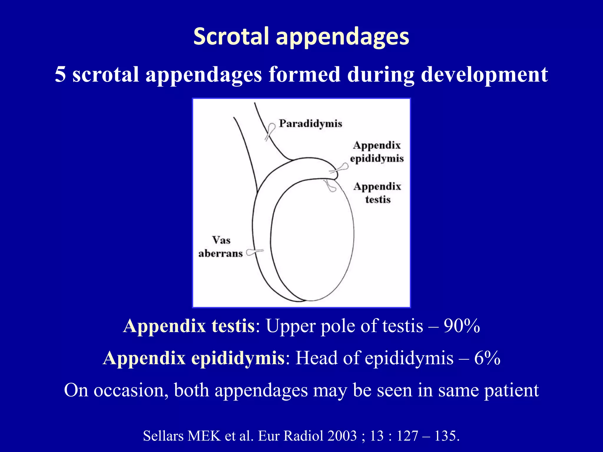 Doppler ultrasound of acute scrotum | PPTX