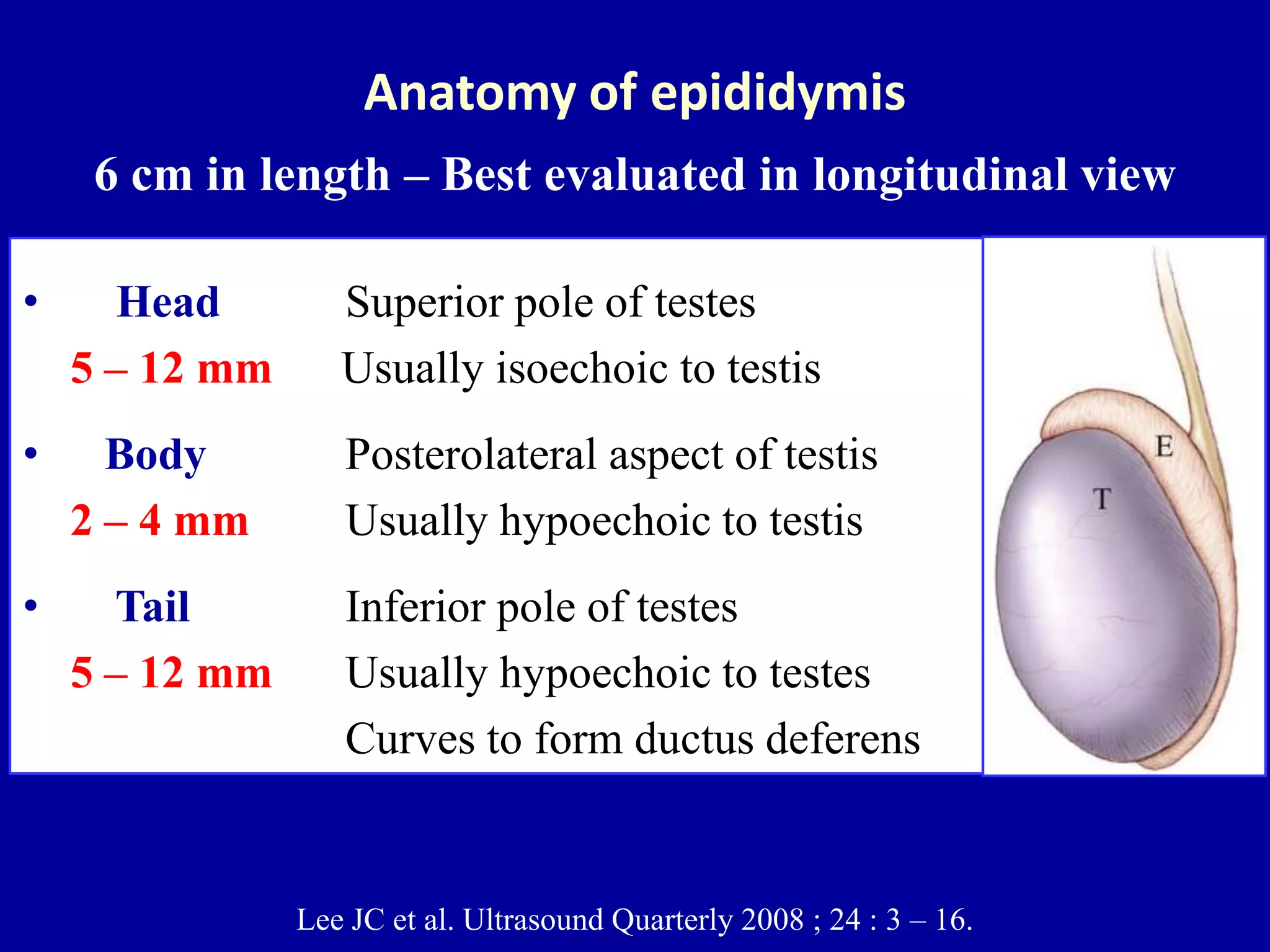 Doppler ultrasound of acute scrotum | PPTX