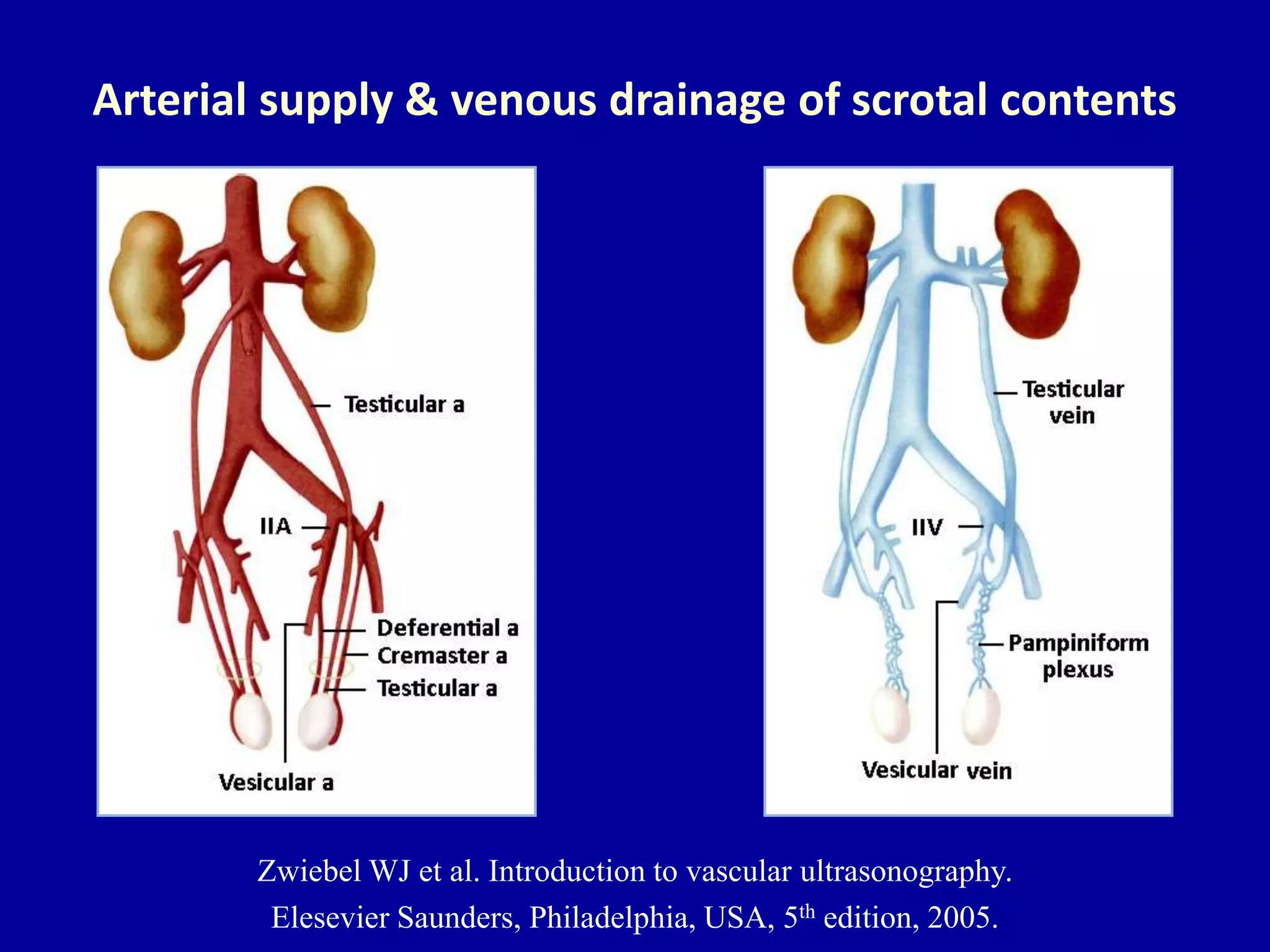 Doppler ultrasound of acute scrotum | PPTX