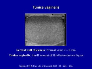 Doppler ultrasound of acute scrotum | PPTX