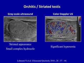 Doppler ultrasound of acute scrotum | PPTX