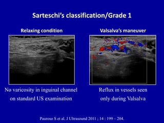 Doppler ultrasound of acute scrotum | PPTX