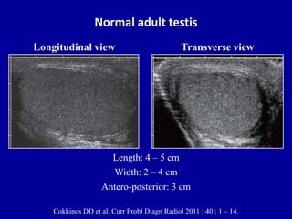 Normal Testis Size