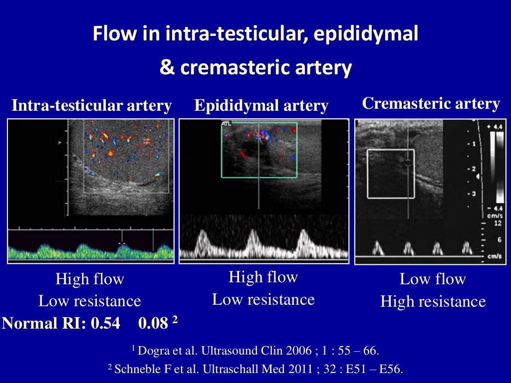 Doppler ultrasound of acute scrotum