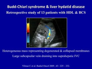 Doppler ultrasound of Budd Chiari syndrome & SOS | PPTX