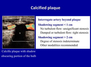 Doppler ultrasound of carotid arteries | PPTX