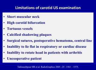 Doppler ultrasound of carotid arteries | PPTX
