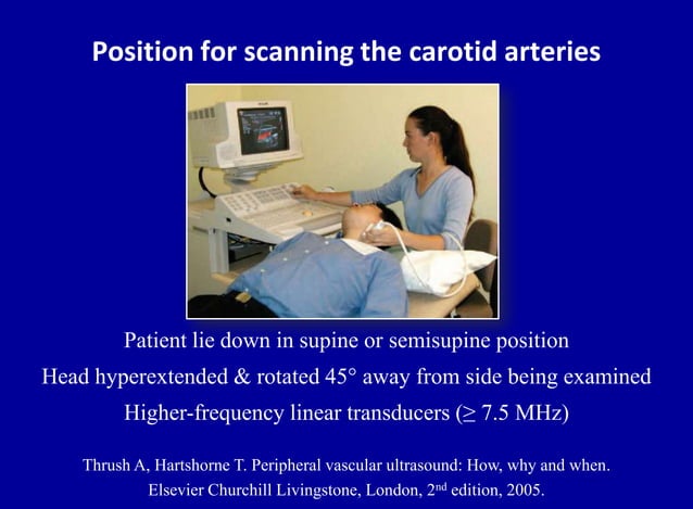 Doppler ultrasound of carotid arteries | PPTX
