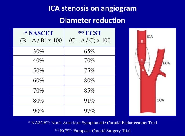 Doppler ultrasound of carotid arteries