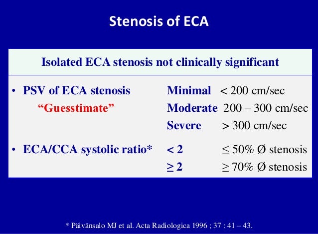 Doppler ultrasound of carotid arteries