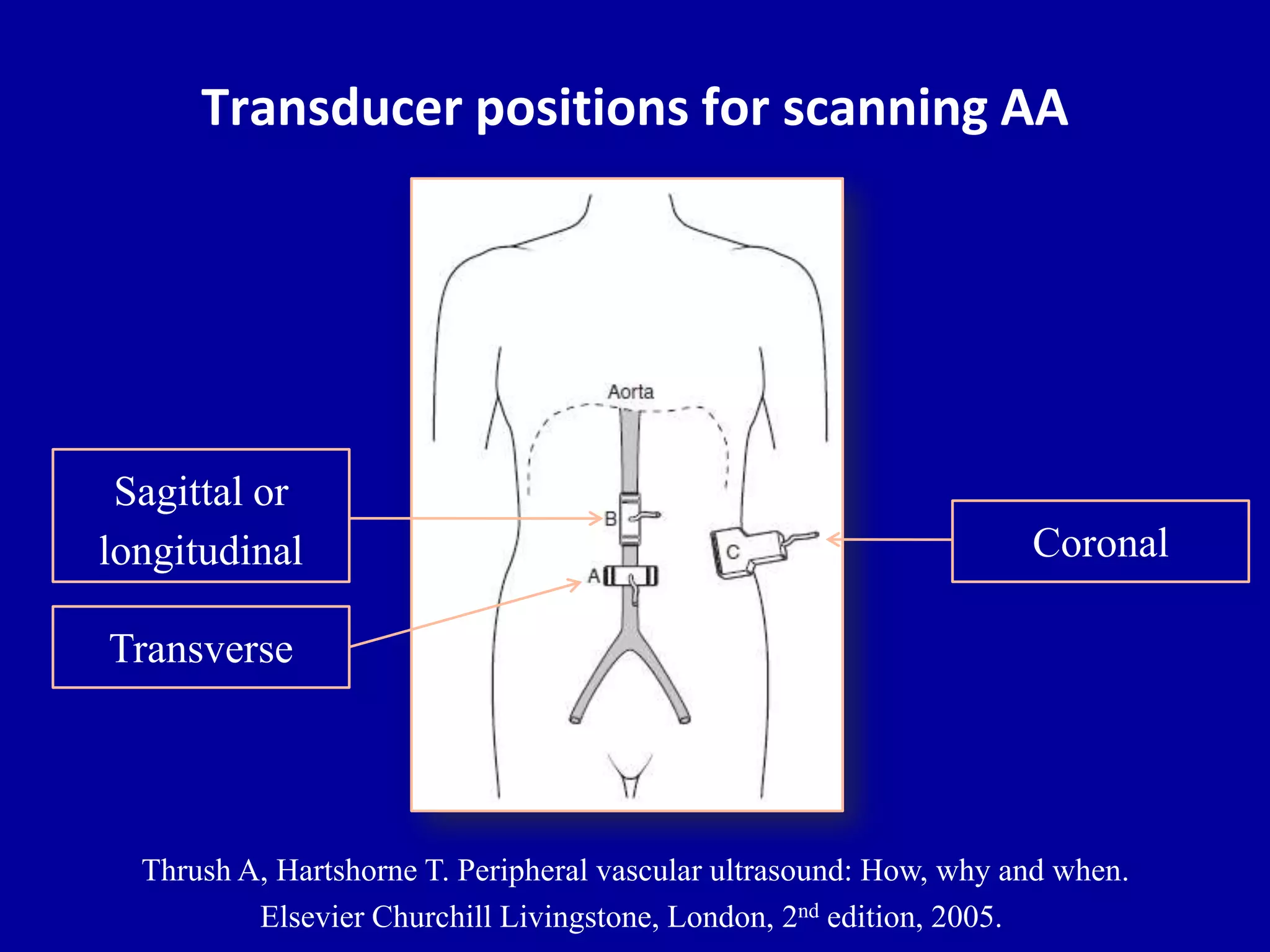 Doppler ultrasound of lower limb arteries | PPTX