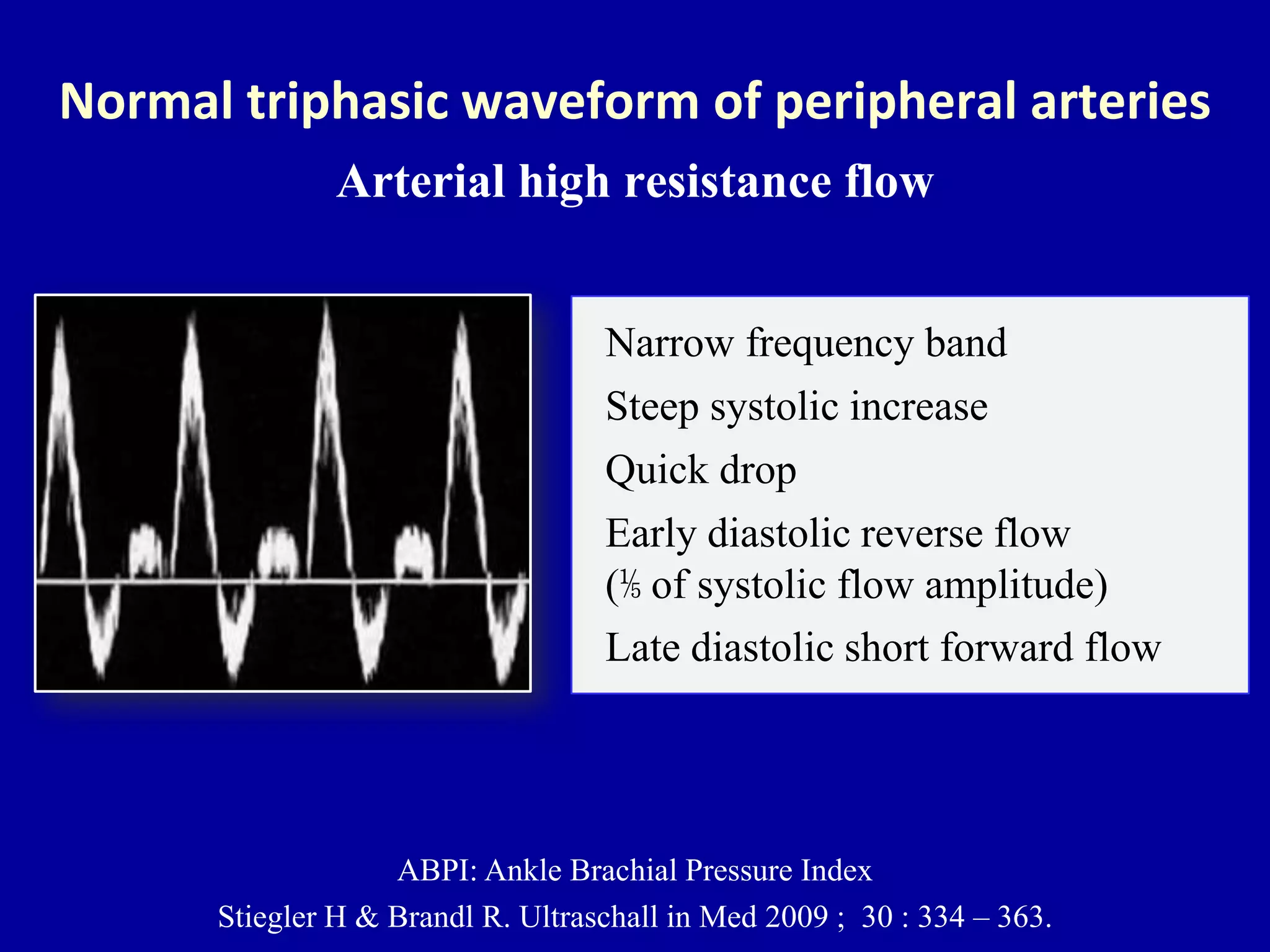 Doppler ultrasound of lower limb arteries | PPTX