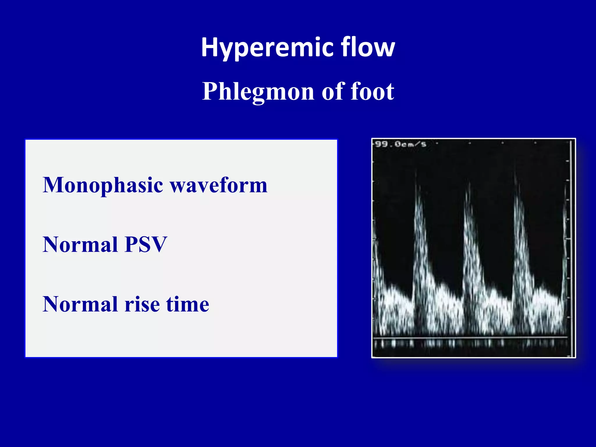 Doppler ultrasound of lower limb arteries | PPTX