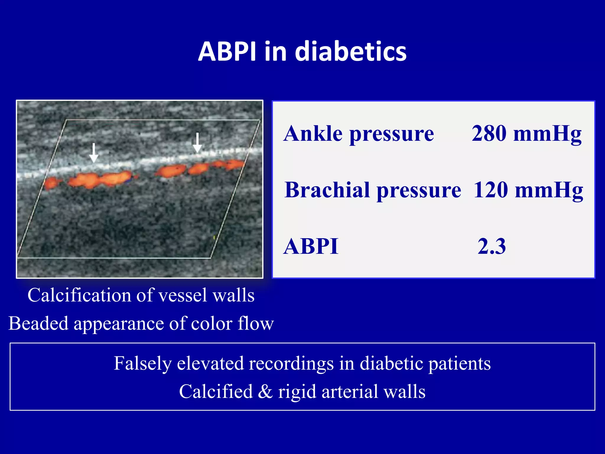 Doppler ultrasound of lower limb arteries | PPTX